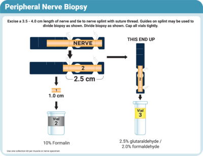Nerve Biopsy - Therapath Neuropathology