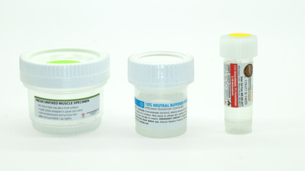 Muscle Biopsy - Therapath Neuropathology